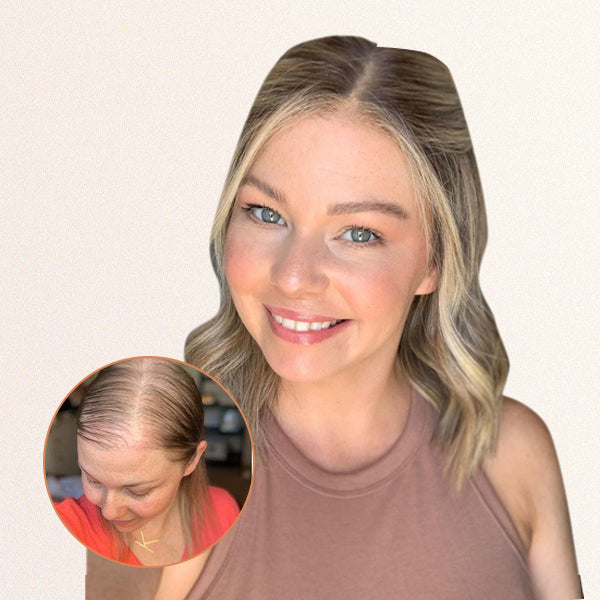 Ulofey.com: Transforming Lives with Innovative Wig Solutions and Socia ...