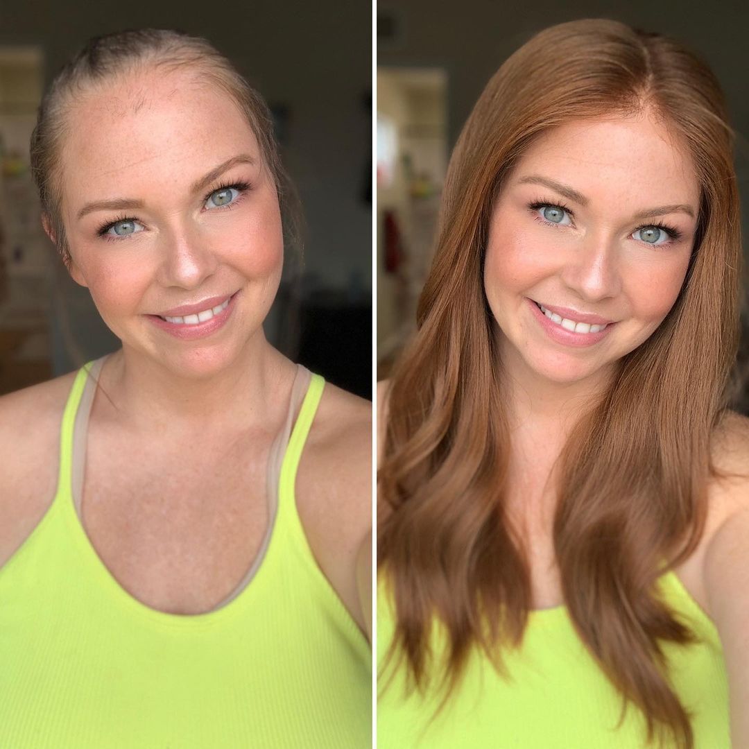 Skin Base Women's Hair Topper for Thinning Hair: Transform Your Look w ...